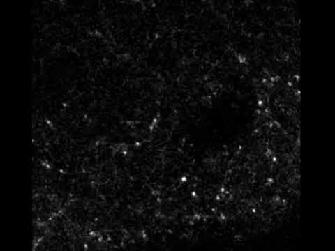 Axonal GCaMP imaging