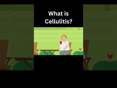 Cellulitis: its Signs, Symptoms, Causes, and Treatments