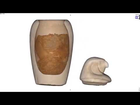 Radiological findings in ancient Egyptian canopic jars