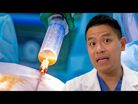 3 Ways To Enlarge Your Penis