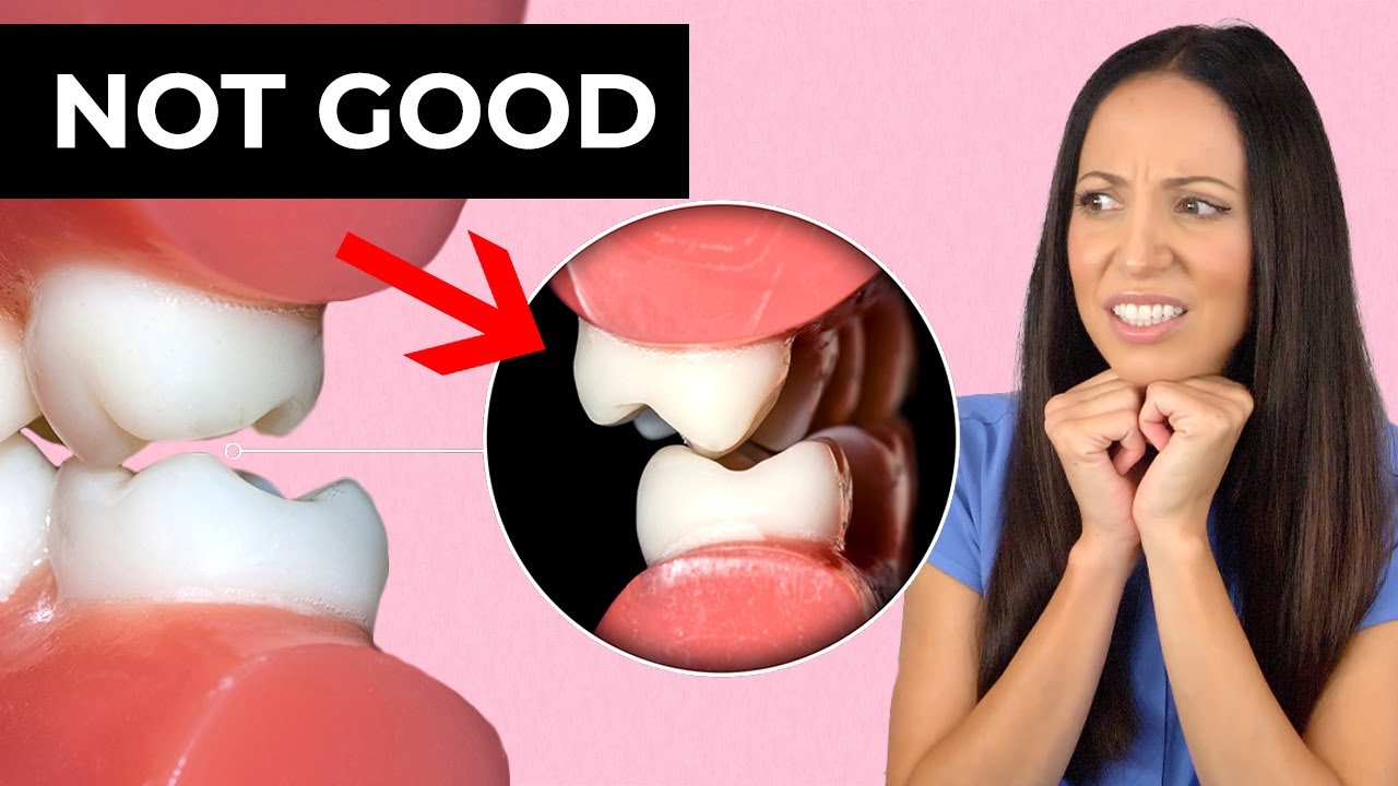 Is Your Bite A Problem?