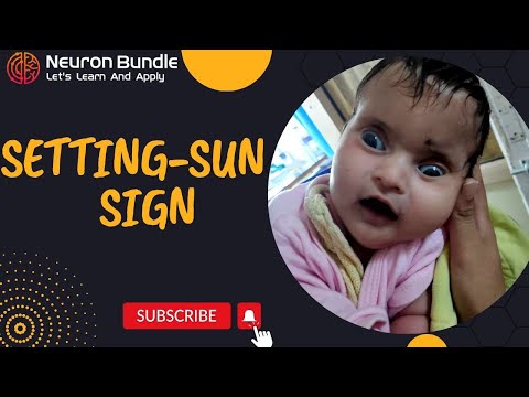 Setting-sun sign | raised intracranial pressure in infants | hydrocephalus #neurology