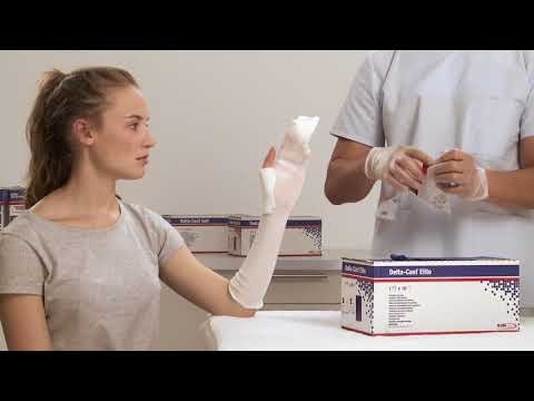 Delta Cast Soft Short Arm Cast Application - Astir