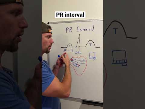 PR Interval and 1st degree AV Block #medicine #ecg #arrhythmia #physiology