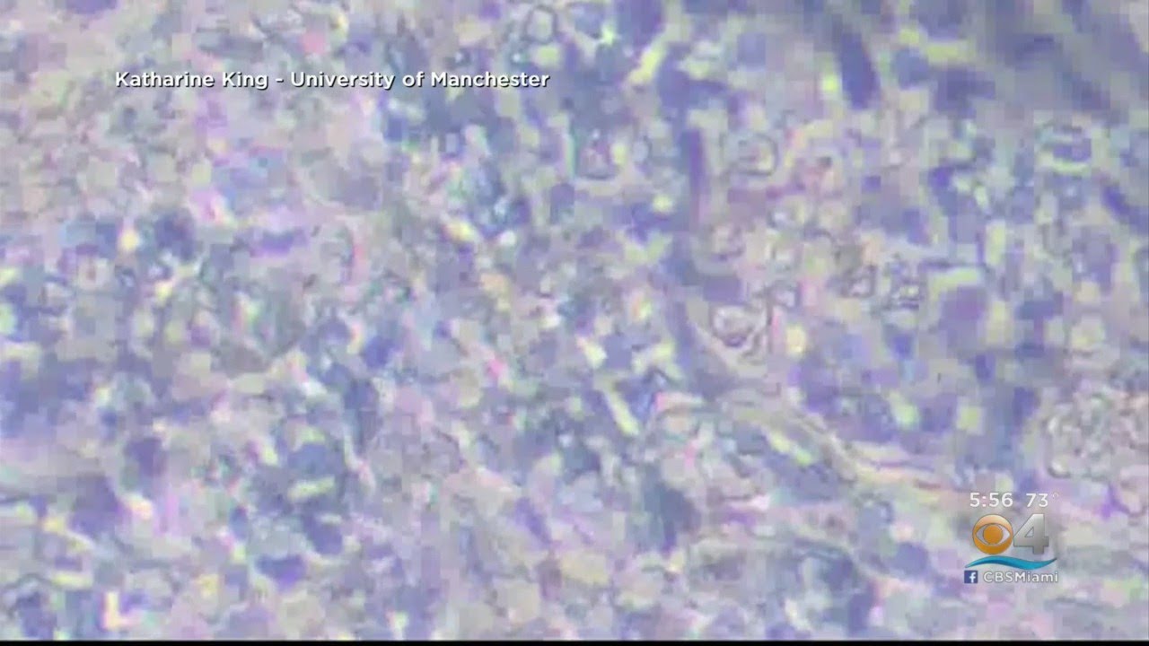 Researchers create special gel to repair damage caused by heart attacks