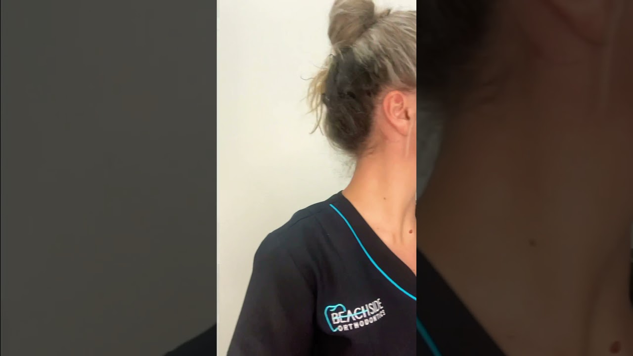 How to place elastics on aligners with cut outs (Class 2)
