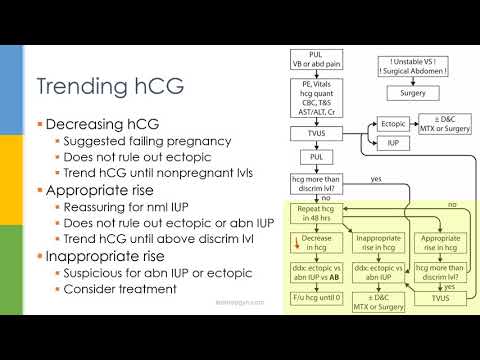 Learn OB/GYN: Ectopic Pregnancy