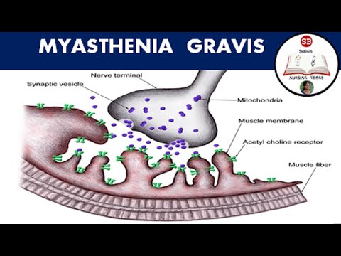 Myasthenia gravis - Incidence, Etiology, Pathophysiology,Classification, Diagnosis,management