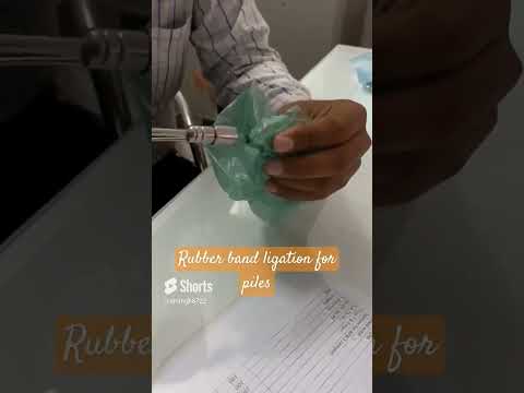 Rubber band ligation for piles | pile gun #piles