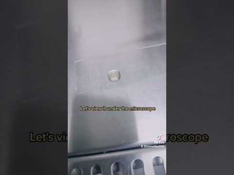 White particles in urine #microscope #urine #urinalysis #laboratory #clinicalmicroscopy