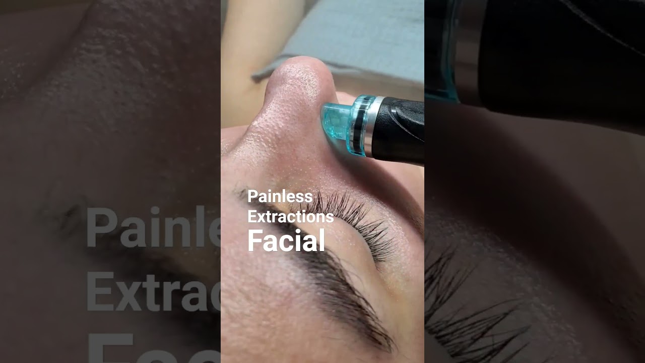 Painless Extractions Facial #facials #faciales #esthetician #Extractions  #facialesprofesionales