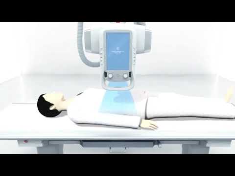 Цифровой рентгеновский аппарат Samsung XGEO GC80 - купить в Москве по ...