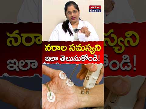 Nerve Conductive Test Uses l NCS TEST l How it is Done #shorts l #drsoumyareddya @MedplusOneTV