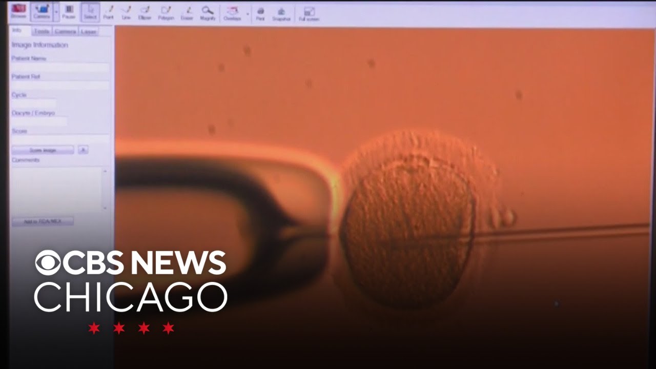 Scientists use human skin cells to create eggs in possible fertility breakthrough