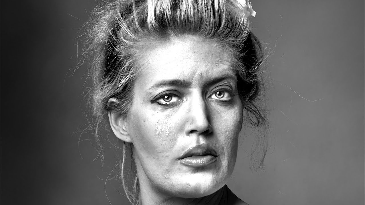 Fentanyl Addict interview-Alexia