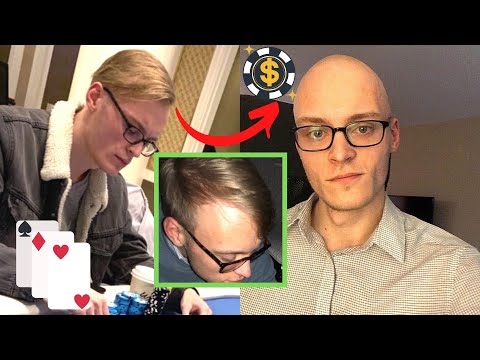 Balding 20's Poker Star Dealt Receding Hairline - Goes ALL IN With Bald Shaved Head