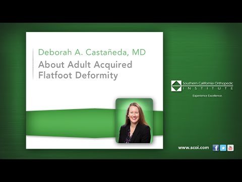 About Adult Acquired Flatfoot Deformity