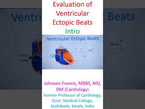 Evaluation of Ventricular Ectopic Beats