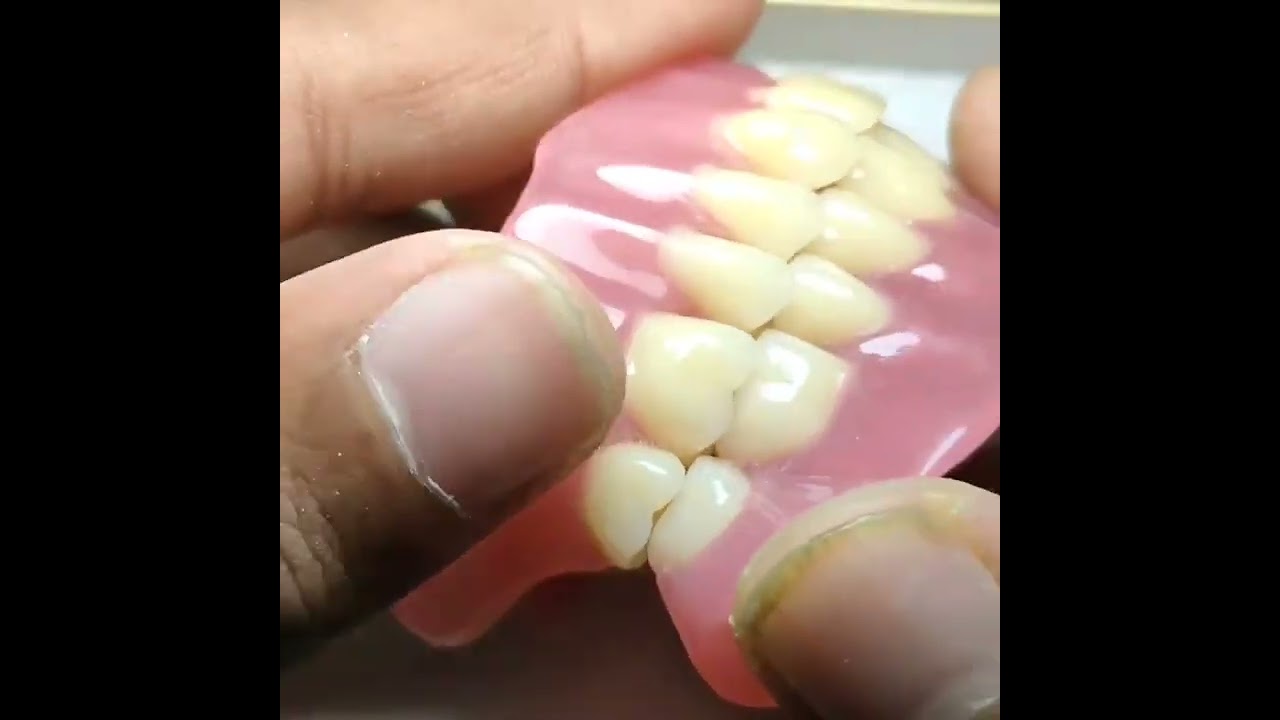 Full Set Dentures by Prof Dental Lab with 25 years experience, Order online: www.rosenthaldent.com