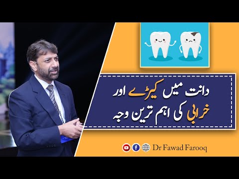Reason of tooth cavities.Urdu/Hindi Dr.Fawad Farooq