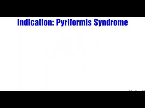 Fluroscopy Guided Piriformis Injection for Sciatica - Dr Bangar Kashinath Painex Pain Clinic Pune