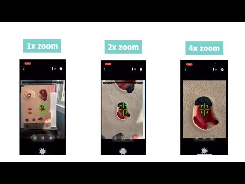 inSight Zoom Capabilities - eKare Inc.