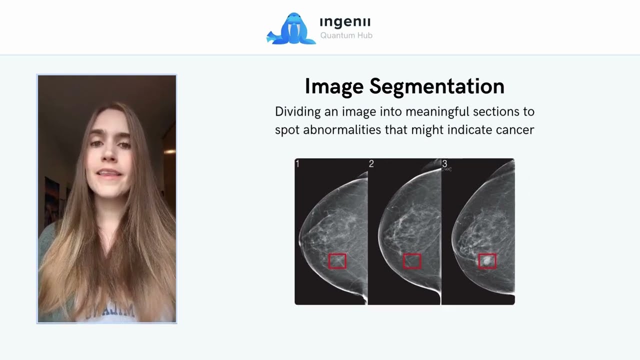 Unsupervised Quantum ML Pipeline for Medical Image Segmentation: Breast Cancer
