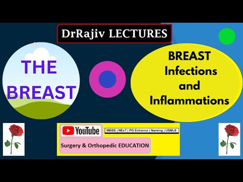 Breast Infections and Inflammations- What you need to know!- DrRajivLECTURES