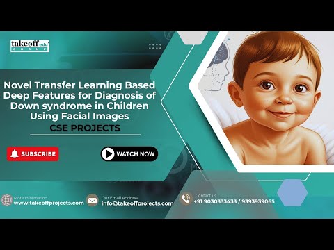 Novel Transfer Learning-Based Deep Features for Diagnosis of Down Syndrome in Children