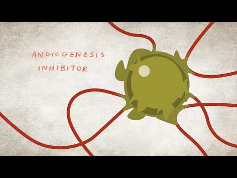 Terapia celowana i rak nerki | Inhibitory angiogenezy i kinaz | National Kidney Foundation