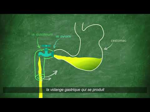 Les spasmes du pylore et les reflux gastro-œsophagiens (RGO) – Fanny ...