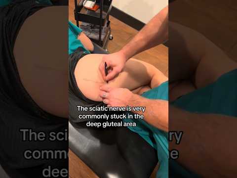 Sciatic Nerve Entrapment Dual Treatment for Chronic #sciatica Over 6 Months