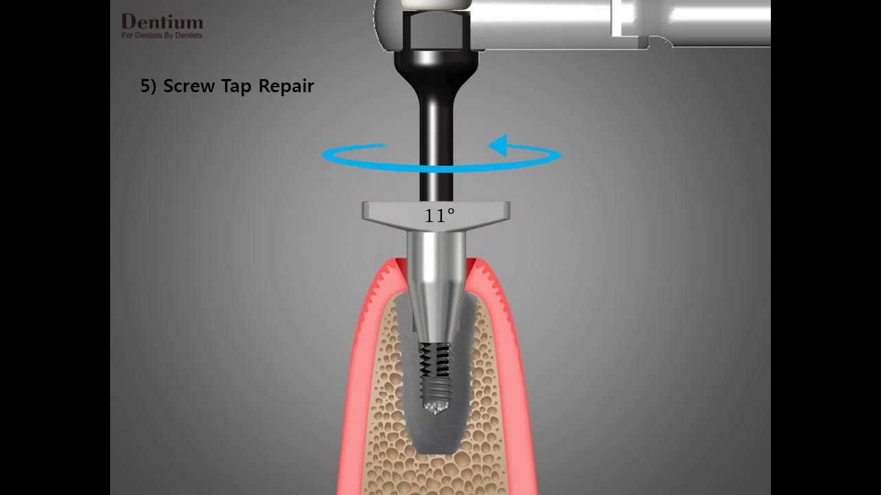 2D Manual Help Kit SE