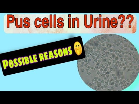 Causes of pus cells in urine|What is pus cells|Pus cells|pus cells in urine