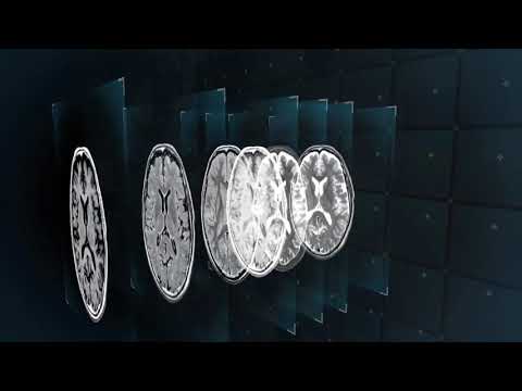 GE SIGNA Pioneer Envision, what you’ve always wished 3 0T could do