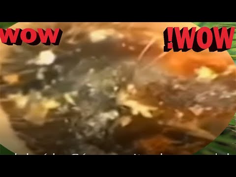 The doctor examined the wax in the ear, affecting our health-EP#335