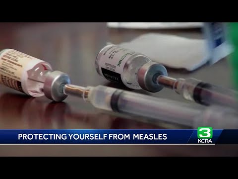 California doctor explains what you need to know about measles and vaccination