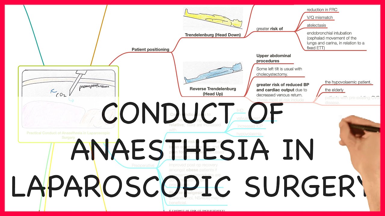 CONDUCT OF ANAESTHESIA IN LAPAROSCOPIC SURGERY- PRACTICAL CONDUCT SERIES