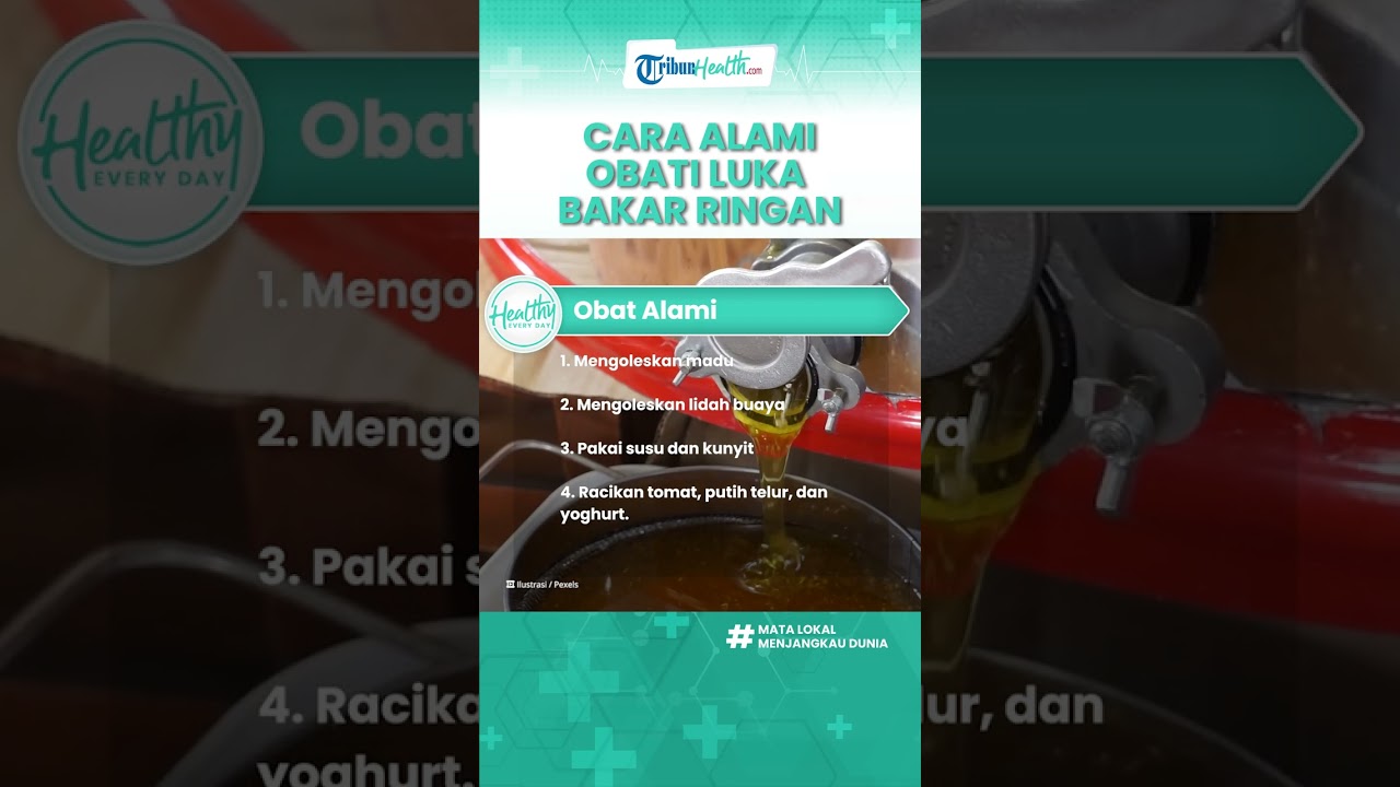 Ini Pertolongan Pertama yang Harus Dilakukan pada Luka Bakar, Oleskan ...