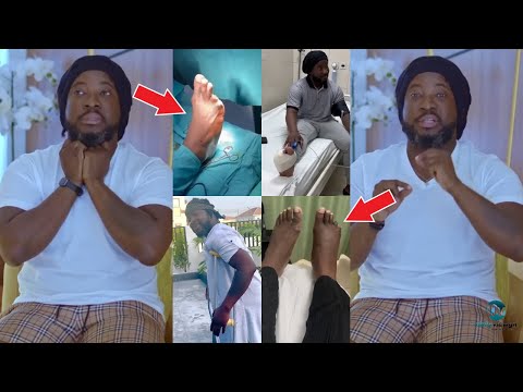 Only Three Toes Left - Sonnie Badu Sαdly Reveals His Acc!dent; Drops Evidence