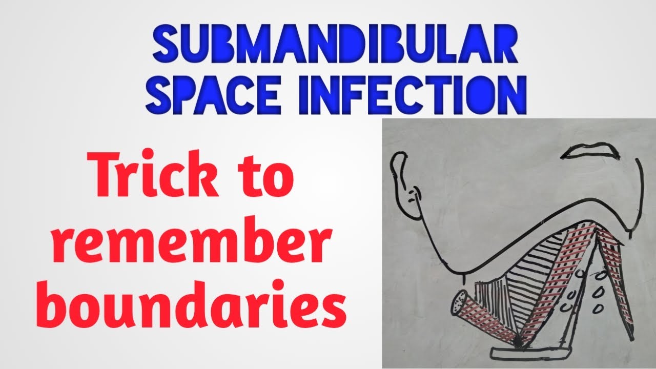 Submandibular space infection - trick to remember boundaries