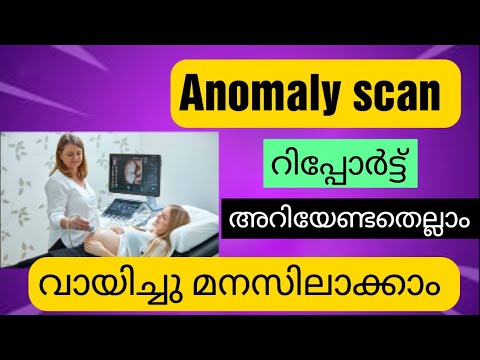 അനോമലി സ്കാൻ. Anomaly scan in pregnancy Malayalam. ഈസി ആയി വായിച്ചു മനസിലാക്കാം.