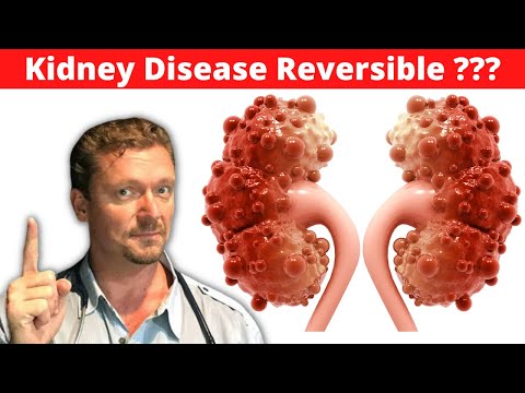 Reverse Chronic Kidney Disease (CKD) [Improve Kidney Function with Diet] 2024