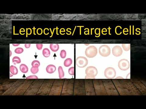 Abnormal Red blood cells having variation in size and shape