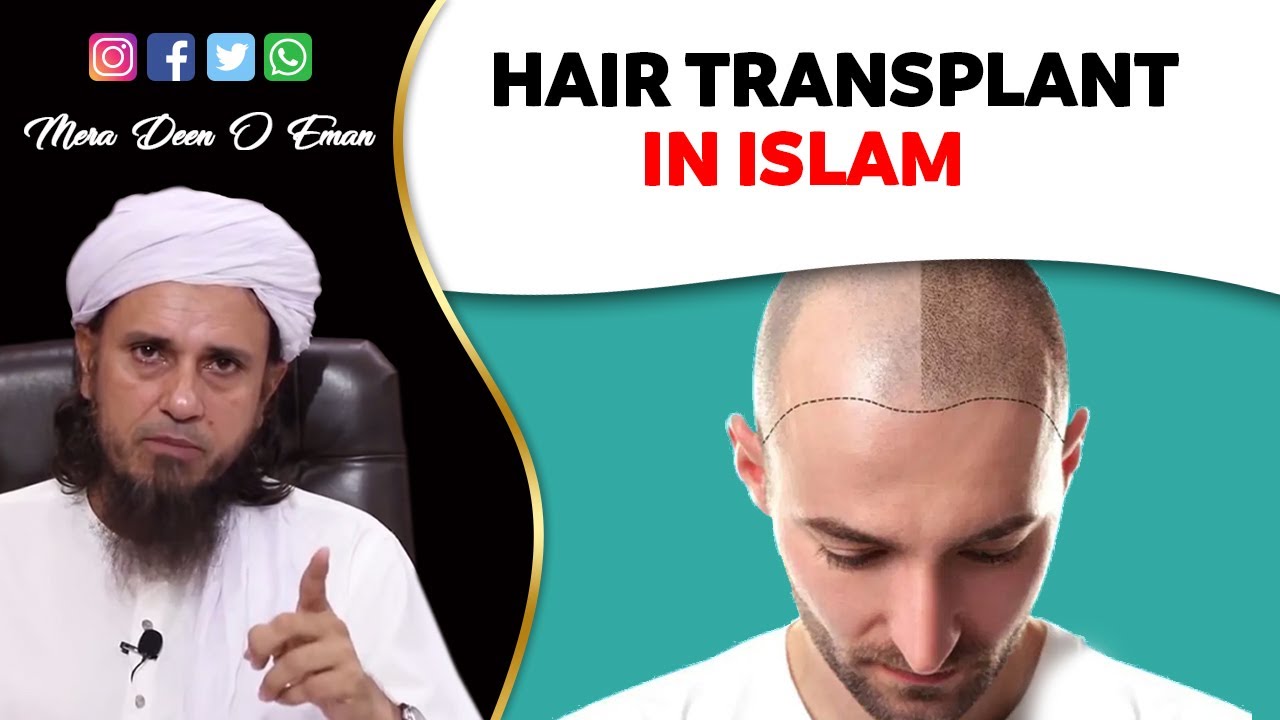 hair transplant karwna kaisa ha Mufti Tariq Masood