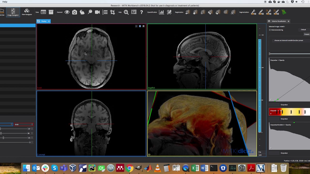 MPHY0026: Volume Rendering Functions