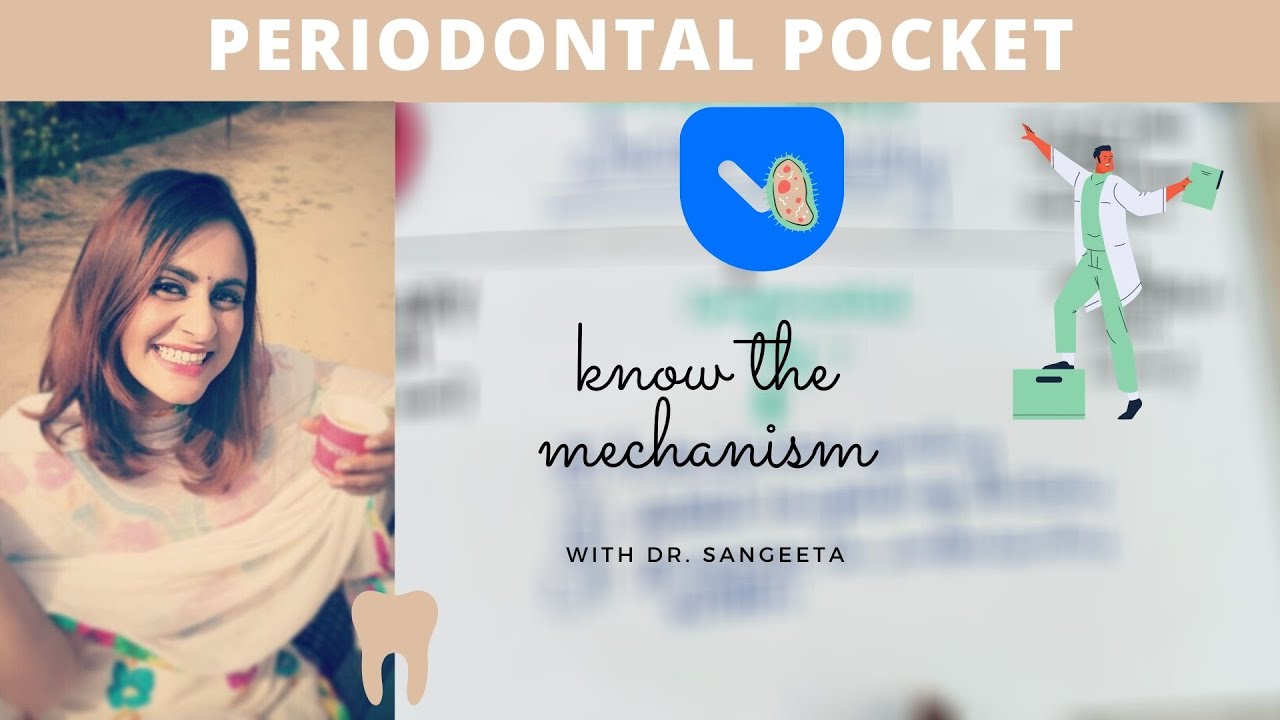 periodontal pocket (carranza)