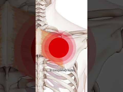 The Rhomboids Trigger Points