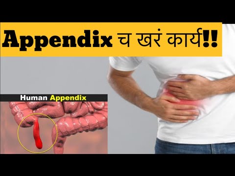 Appendix in Marathi-#shortsvideo #who #appendicularskeleton #abdomen #pain#appendix