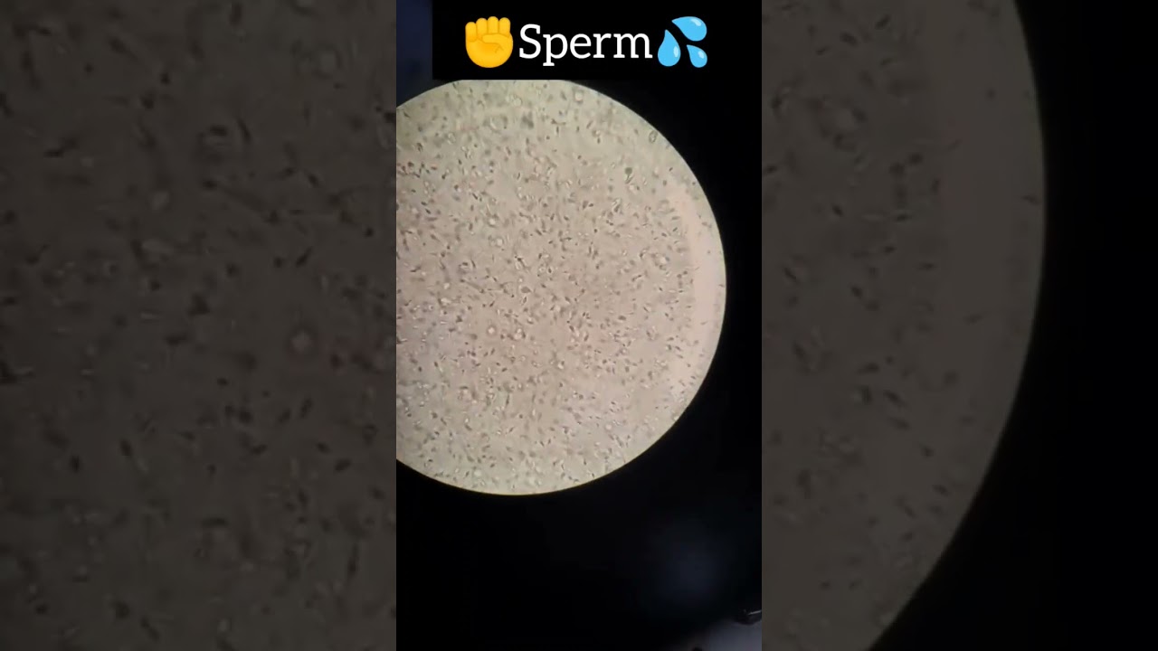 microscopic view of sperm || #sperm,#shorts, #misterindianhacker, #souravjoshivlogs,#mister_prophase